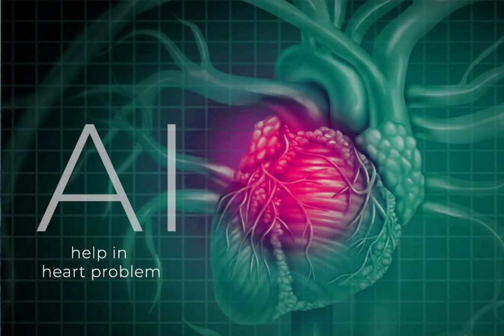 Artificial Intelligence Might Helpful To Detect Heart Problems